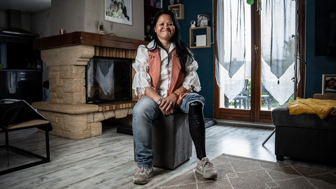 In 1982, HI provided Emilie with her first prosthesis | Humanity ...
